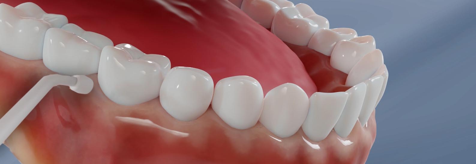 Beyond Brushing: How to Floss with Proper Technique - Meyerwood Dentistry